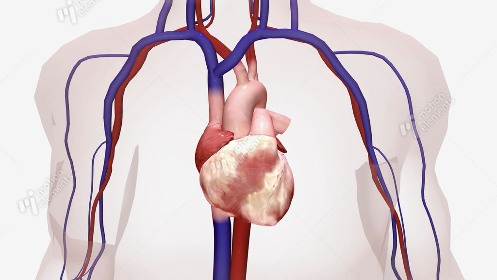 Ventricular Fibrillation Gif