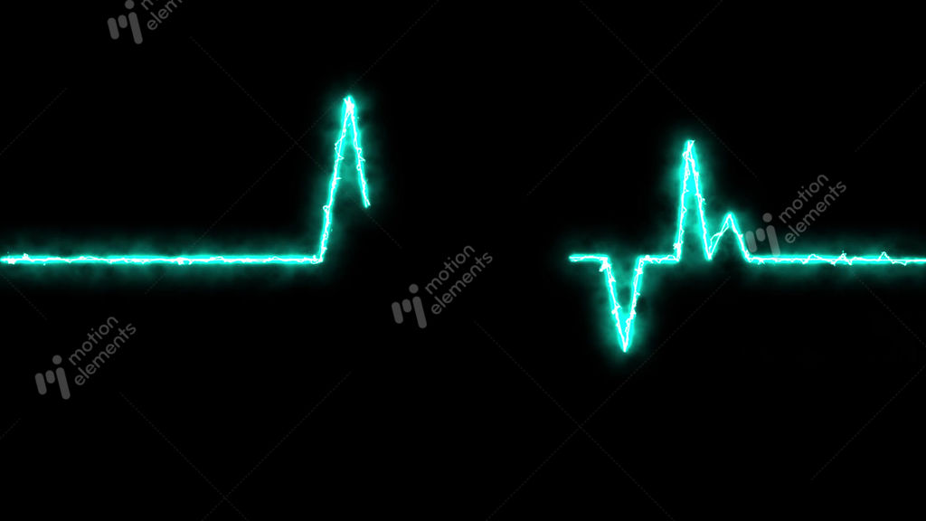 Animated Heartbeat Graphic